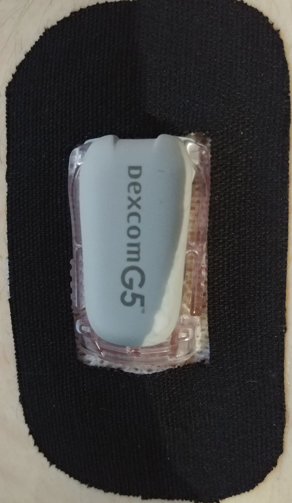 Basic Dexcom G5/G6 tape template by Arakon | Download free STL model ...