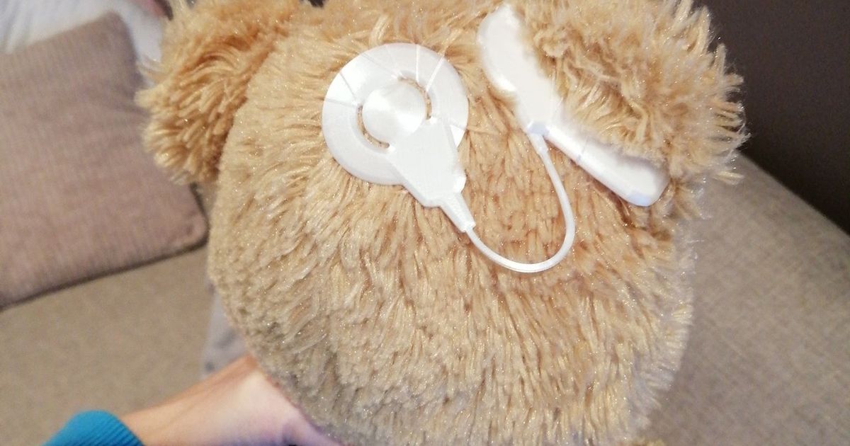 Cochlear Implant Model by Matt | Download free STL model | Printables.com