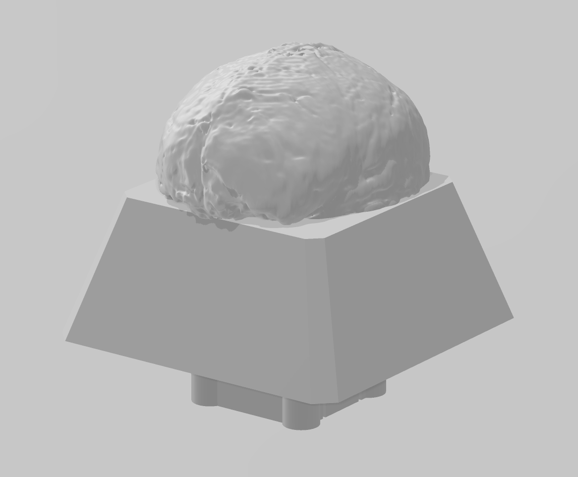 "Brain Scan" REAL MRI Data Key Cap Razer Cynosa V2 by WEBB3DMFG ...