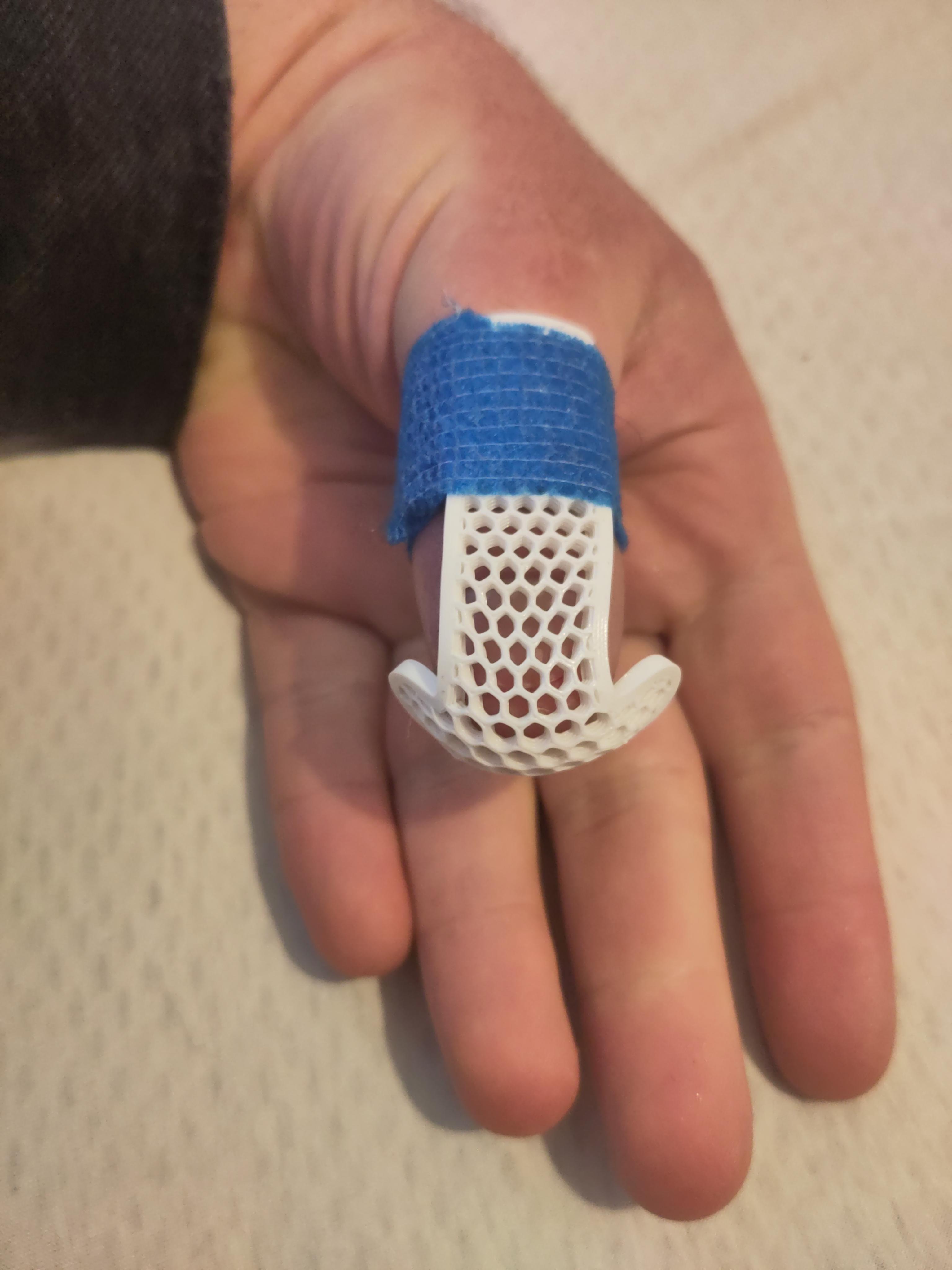 thumb brace by Johnny | Download free STL model | Printables.com