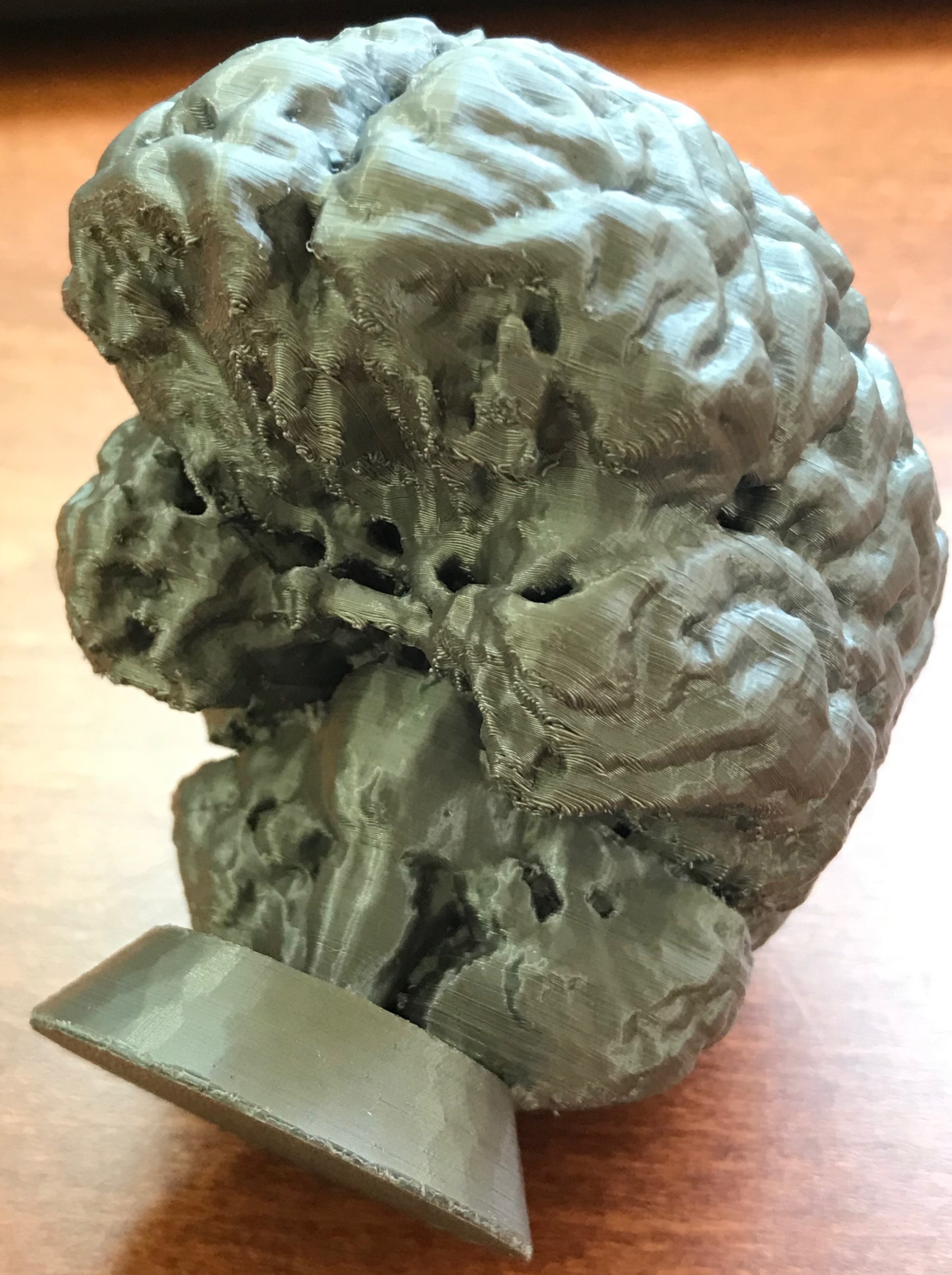 Brain by KrustyKrab | Download free STL model | Printables.com