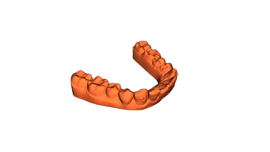 dental model of complete arch by Joje | Download free STL model ...