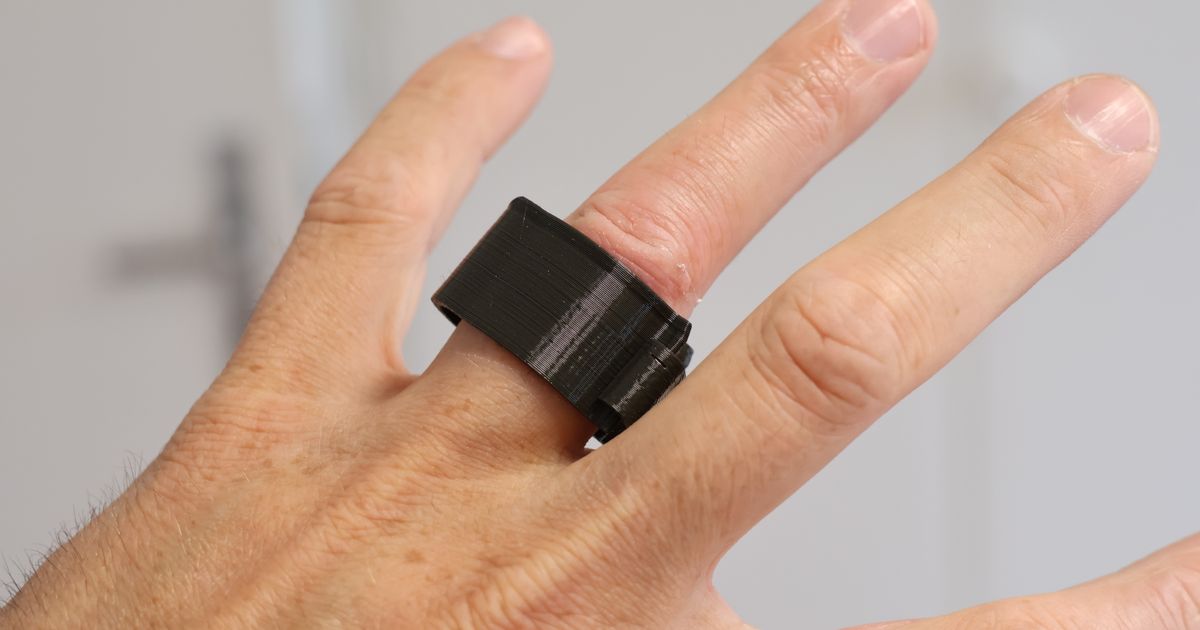 A2 Pulley Ligament at Gail Gaskell blog