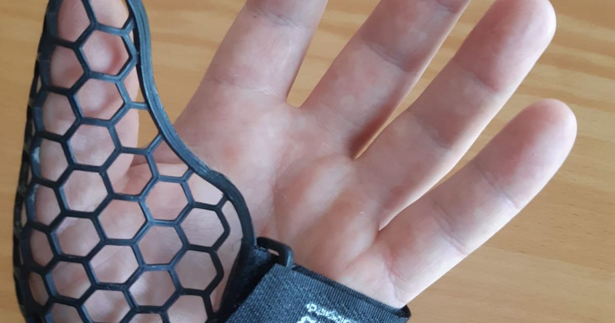 Thumb Splint by pflotschhoger | Download free STL model | Printables.com