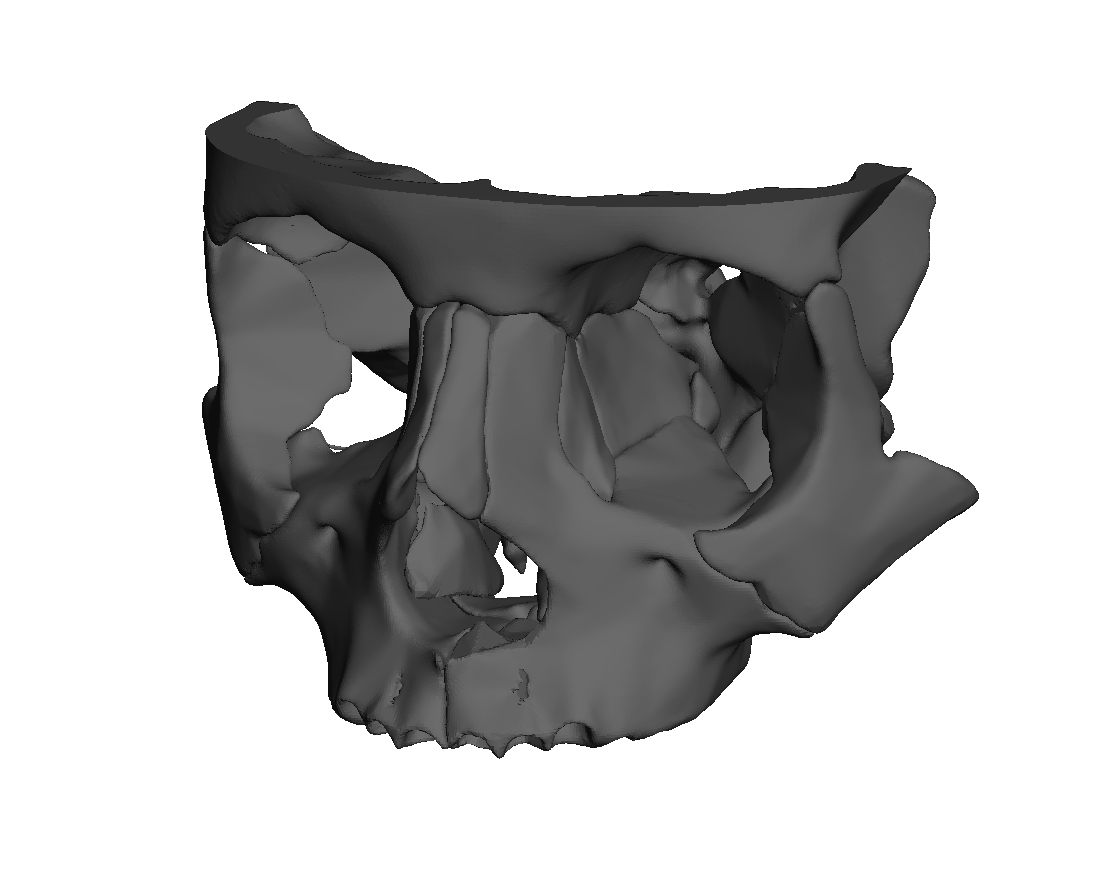 Orbit bones anatomical model by diegotrap | Download free STL model ...