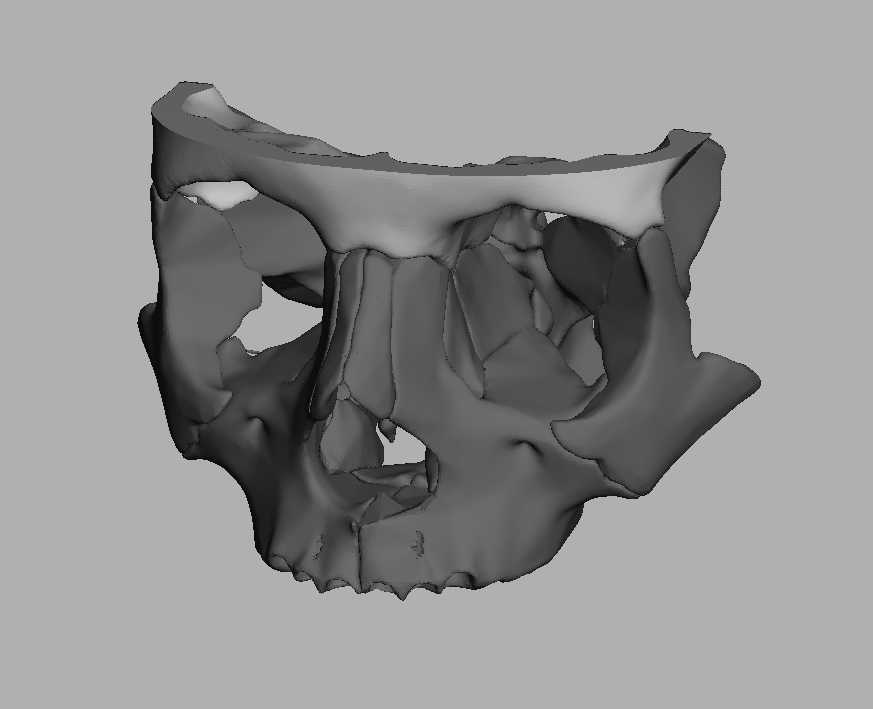 Orbit bones anatomical model by diegotrap | Download free STL model ...