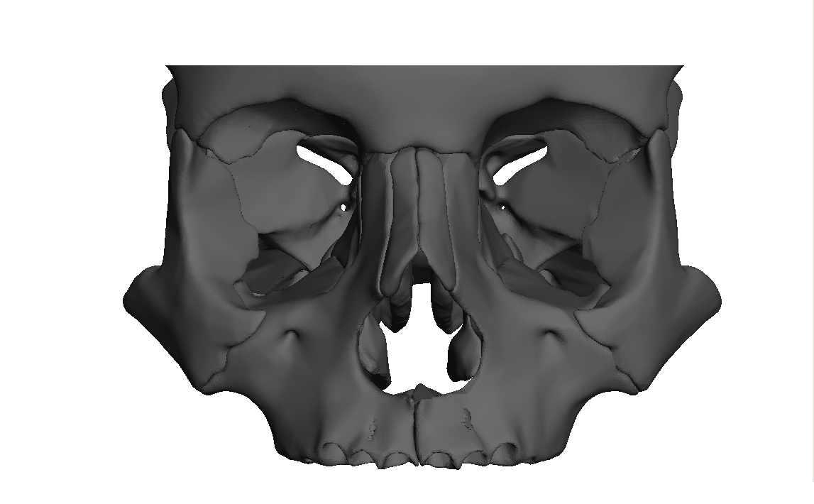 Orbit bones anatomical model by diegotrap | Download free STL model ...