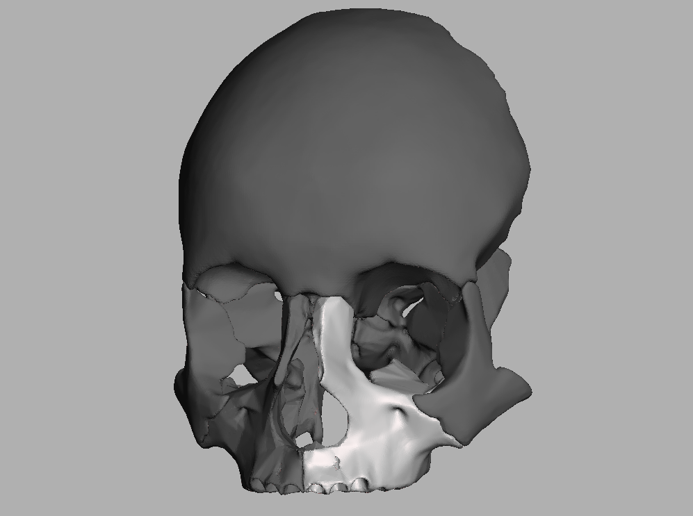 Orbit bones anatomical model by diegotrap | Download free STL model ...