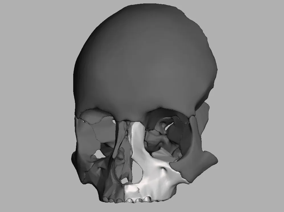 Orbit bones anatomical model by diegotrap | Download free STL model ...