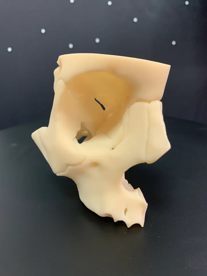 Orbit bones anatomical model by diegotrap | Download free STL model ...
