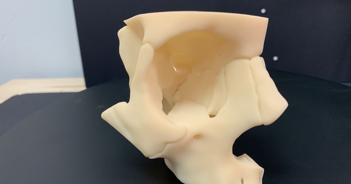 Orbit bones anatomical model by diegotrap | Download free STL model ...