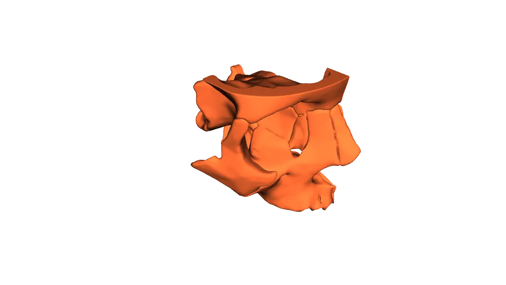 Orbit bones anatomical model by diegotrap | Download free STL model ...