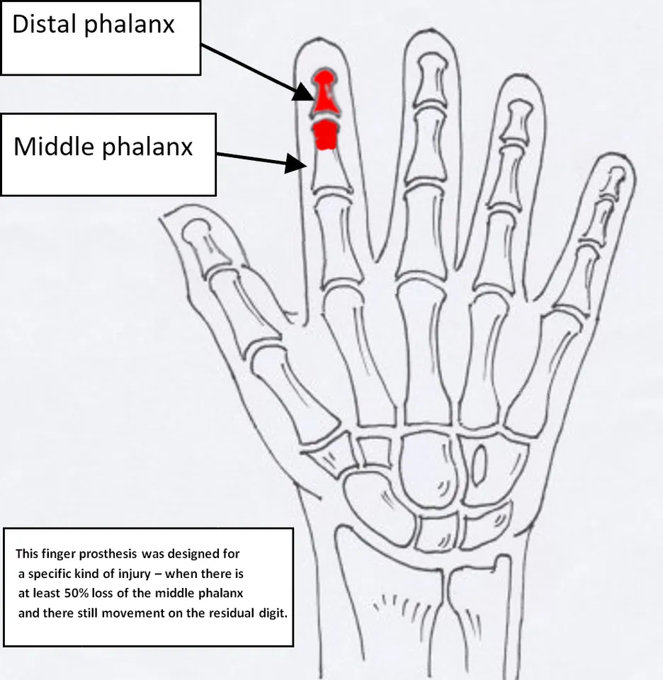 BioMech Finger Prosthesis (Index Right Hand) by Maximilium XYZ ...