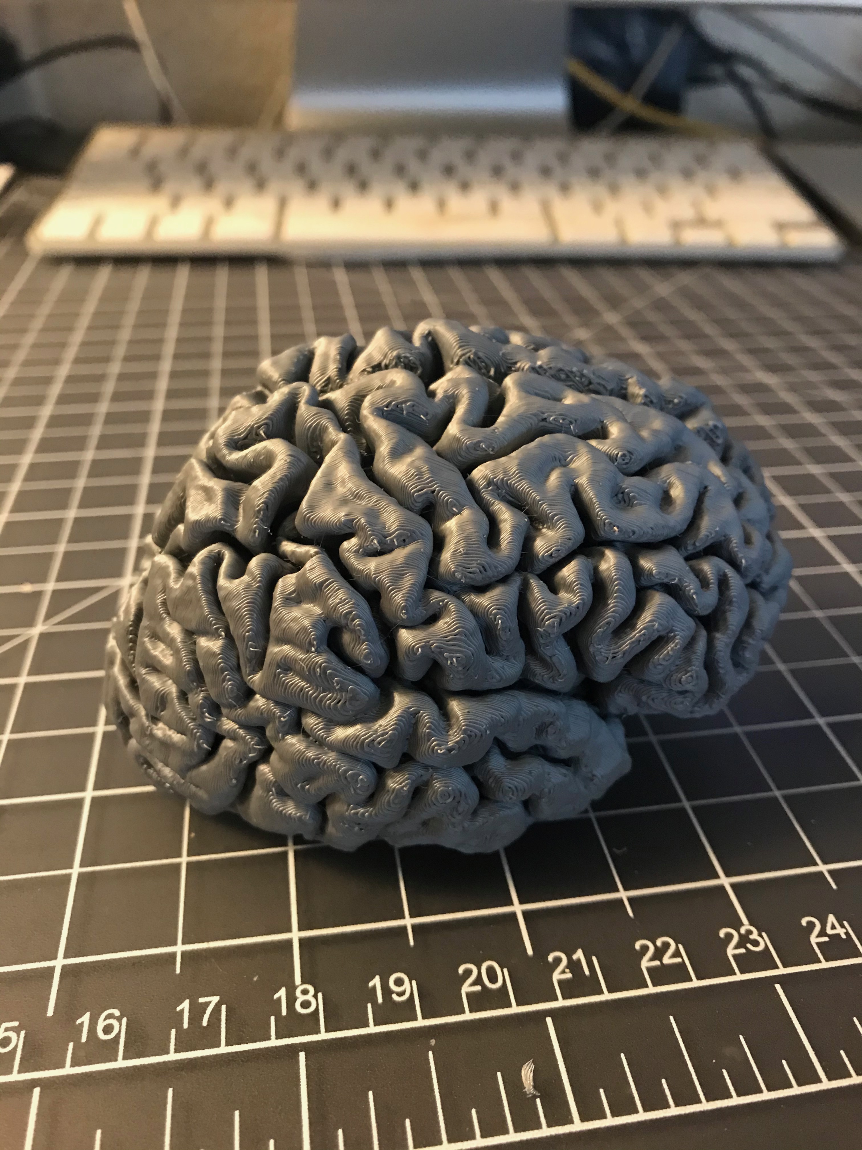 Human Brain Hemispheres from MRI data by Randy | Download free STL ...