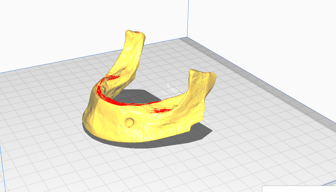 training mandible without teeth of lower jaw by H- printed | Download ...