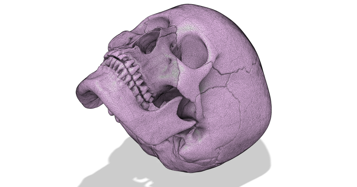 Human skull (exploded) by eurad | Download free STL model | Printables.com