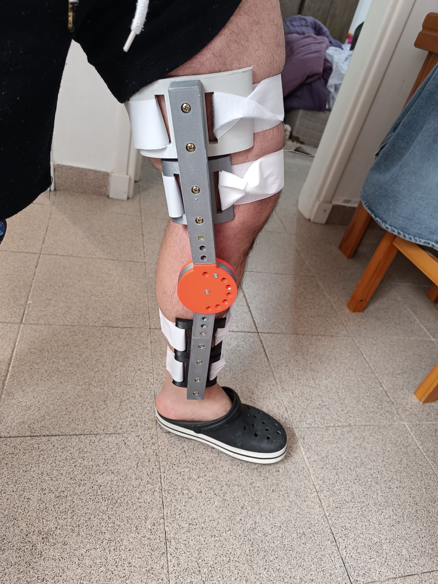 Adjustable Knee Cast Medical Orthopedic Support by Cartagines ...