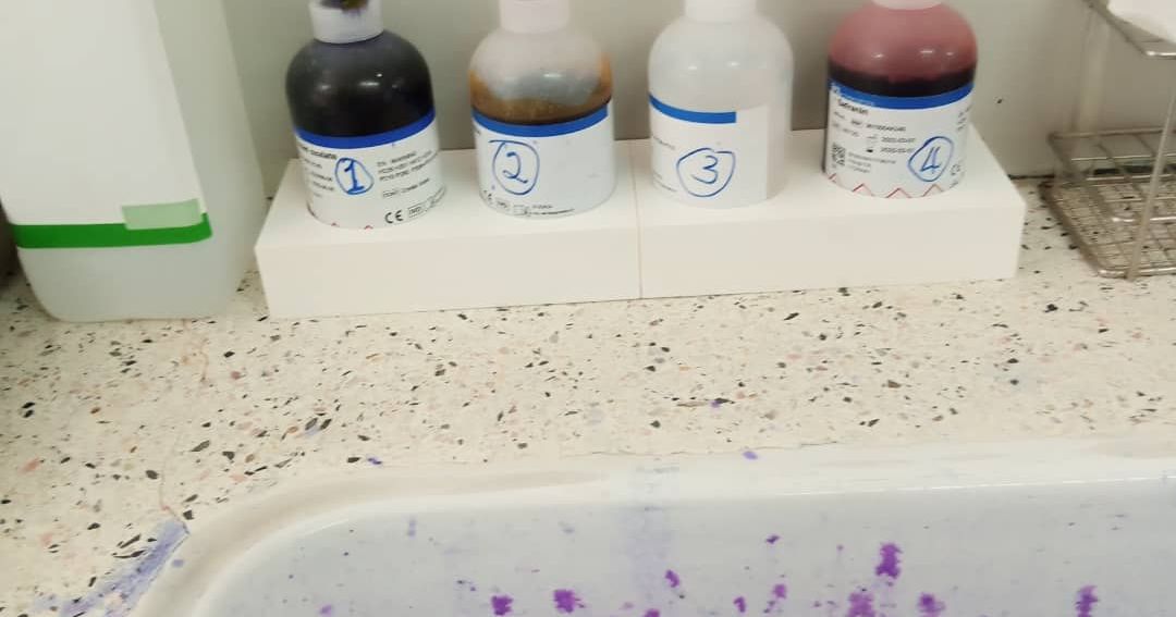 Reagent holder by Médecins Sans Frontières | Download free STL model ...