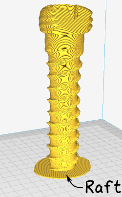 Trabecular bone osteoporosis model with bone screw by akimakes ...