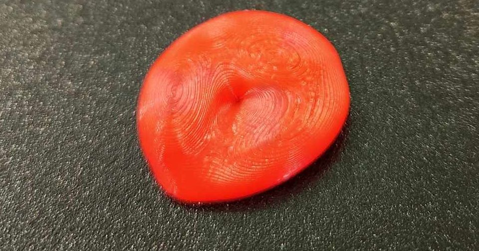 Stoma Model (Education) by Lurie Childrens Tech | Download free STL ...