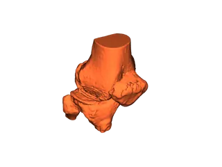 Anatomically correct right knee with degradation by KeeJayBe | Download ...