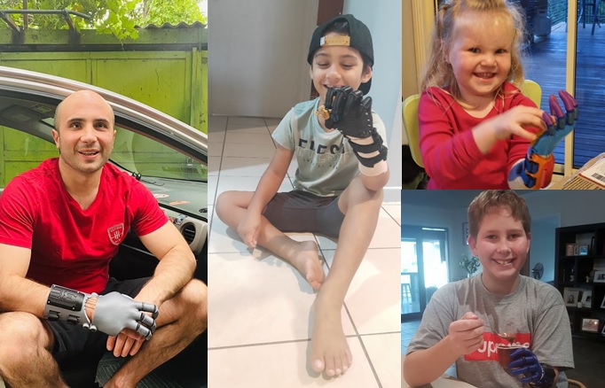 Kinetic Hand from Mat Bowtell by eNABLE | Download free STL model ...