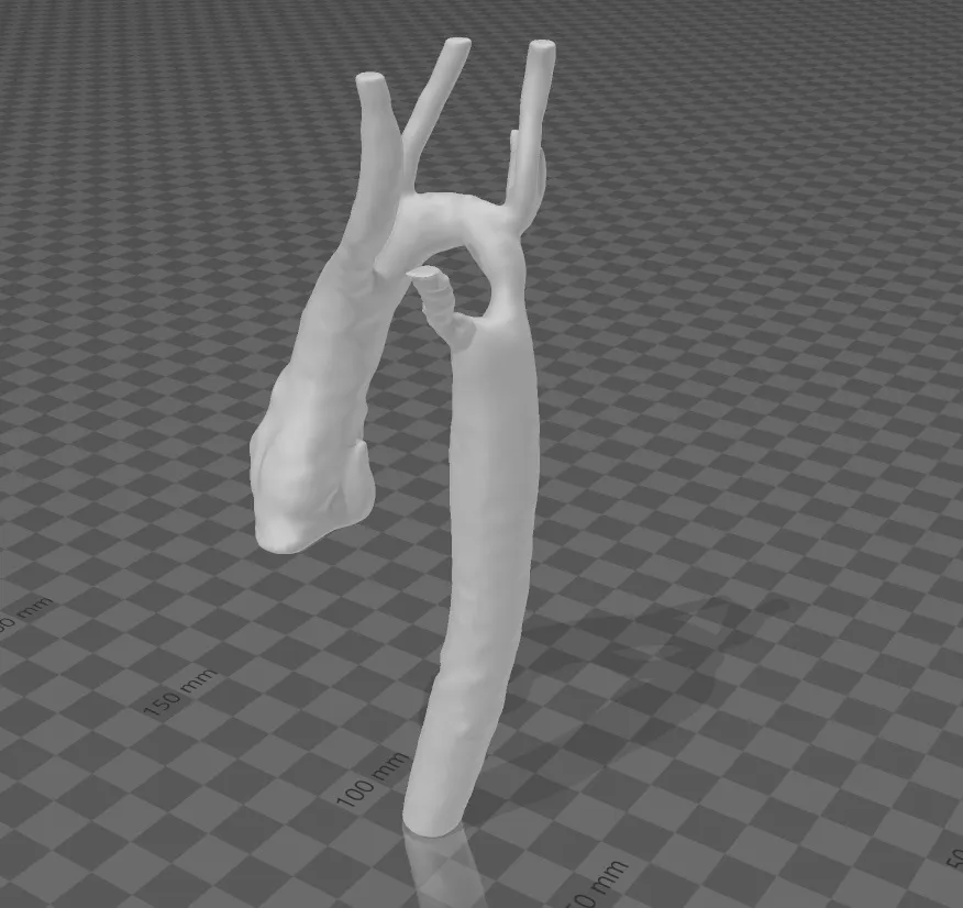 Aorta by Paweł Ozga | Download free STL model | Printables.com