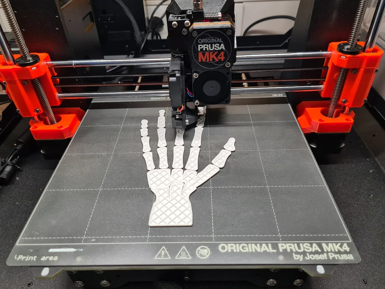 Skeleton hand (movable) by Wilko_SLO | Download free STL model ...