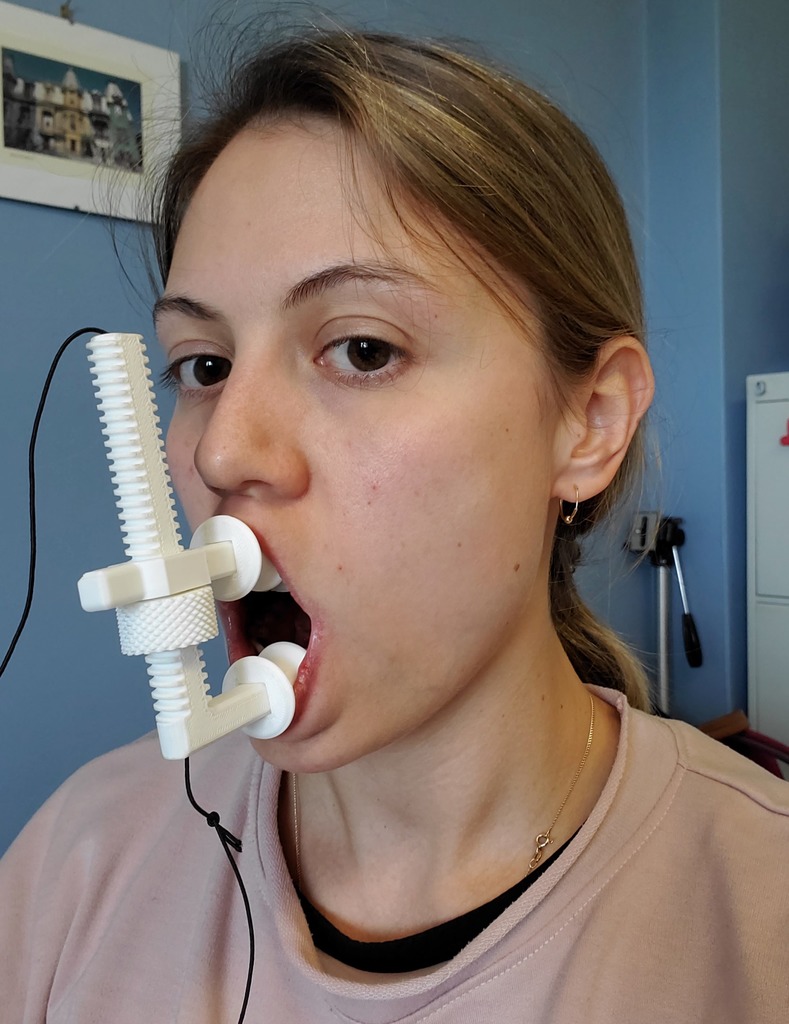 Microstomia Splint + Adjustments by Zoë Edger-Lacoursière | Download ...