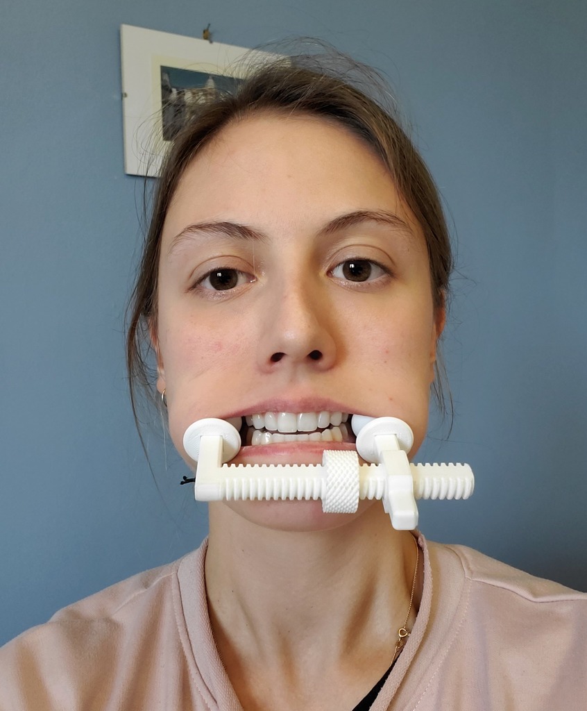 Microstomia Splint + Adjustments by Zoë Edger-Lacoursière | Download ...