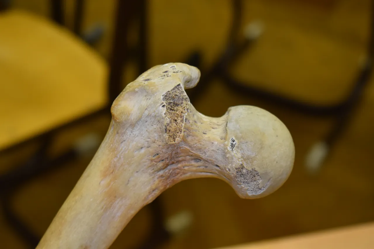 Thigh Bone Scan - Femur by KubiV | Download free STL model | Printables.com