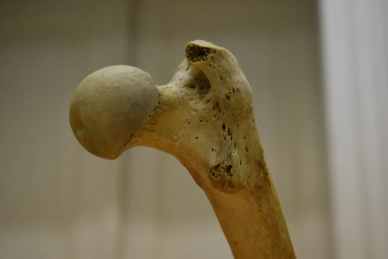 Thigh Bone Scan - Femur by KubiV | Download free STL model | Printables.com