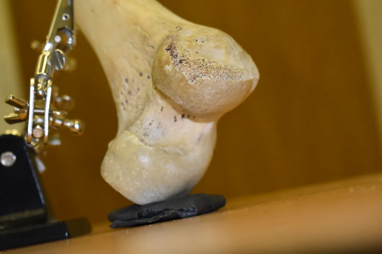 Thigh Bone Scan - Femur by KubiV | Download free STL model | Printables.com