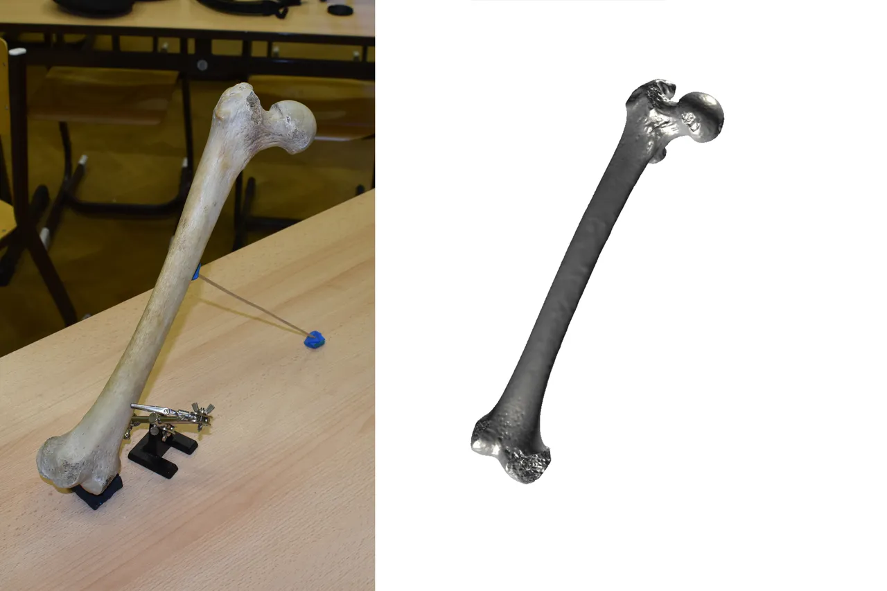 Thigh Bone Scan - Femur by KubiV | Download free STL model | Printables.com