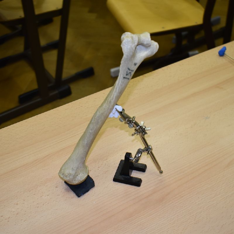 Upper Arm Bone Scan - Humerus (R) by KubiV | Download free STL model ...