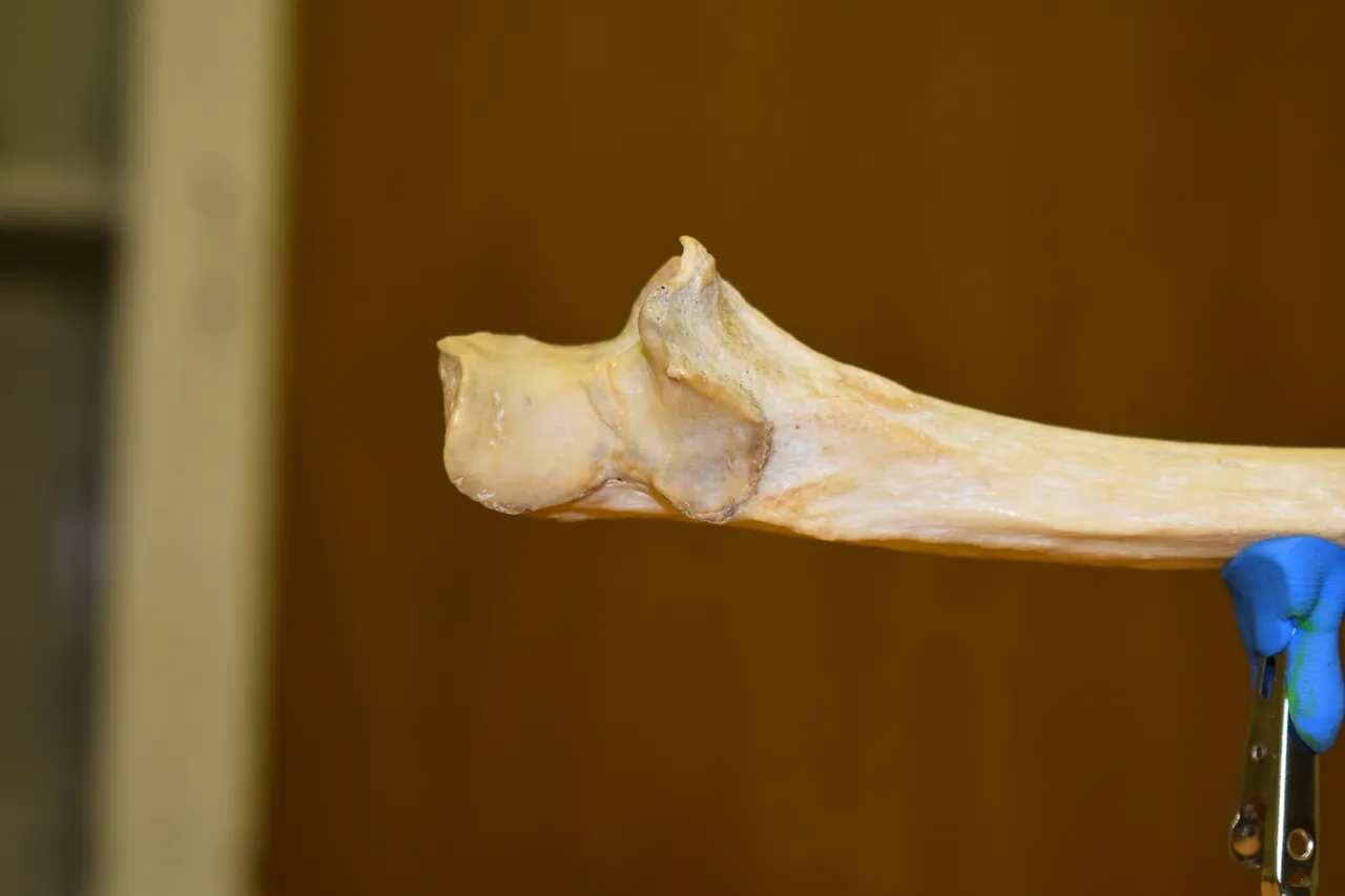 Forearm Bone Scan - Ulna by KubiV | Download free STL model ...