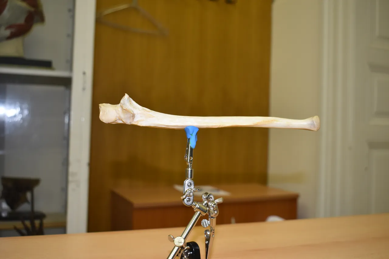 Forearm Bone Scan - Ulna by KubiV | Download free STL model ...