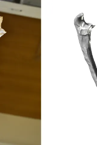 Forearm Bone Scan - Ulna by KubiV | Download free STL model ...