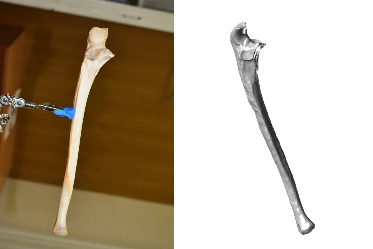 Forearm Bone Scan - Ulna by KubiV | Download free STL model ...