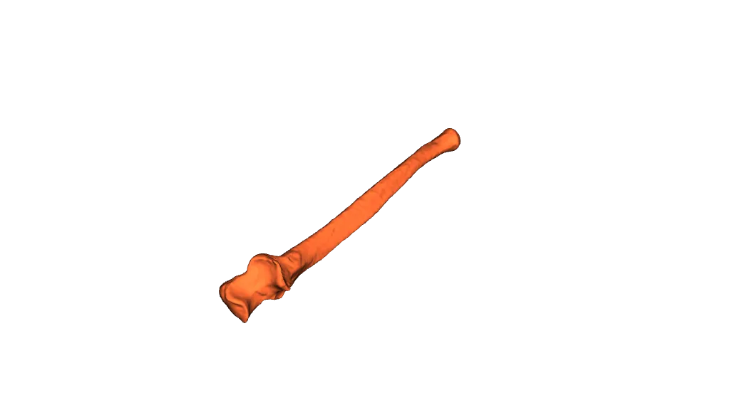 Forearm Bone Scan - Ulna by KubiV | Download free STL model ...