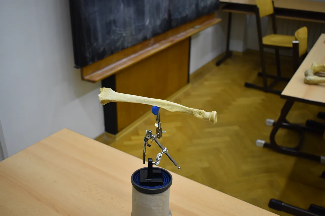 Forearm Bone Scan - Radius by KubiV | Download free STL model ...