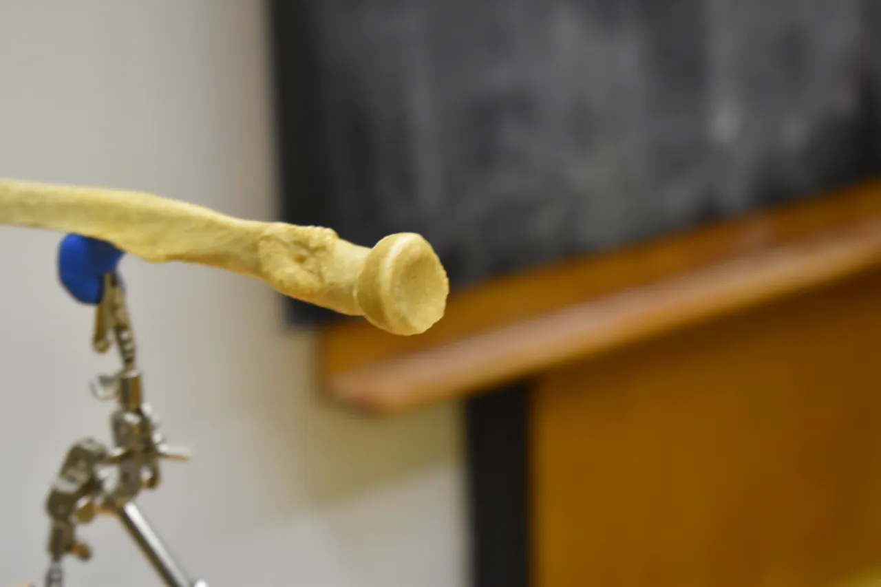 Forearm Bone Scan - Radius by KubiV | Download free STL model ...