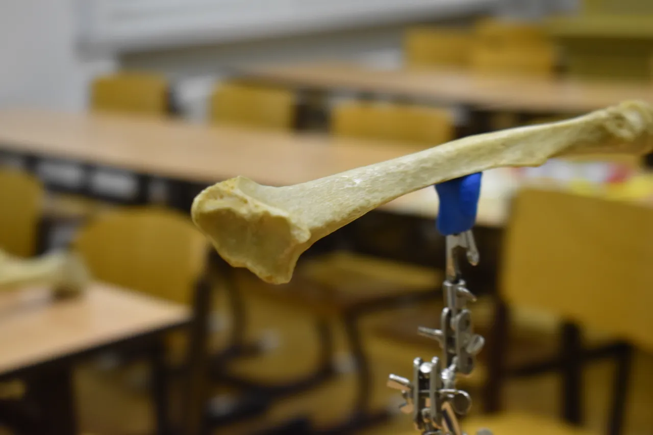Forearm Bone Scan - Radius by KubiV | Download free STL model ...