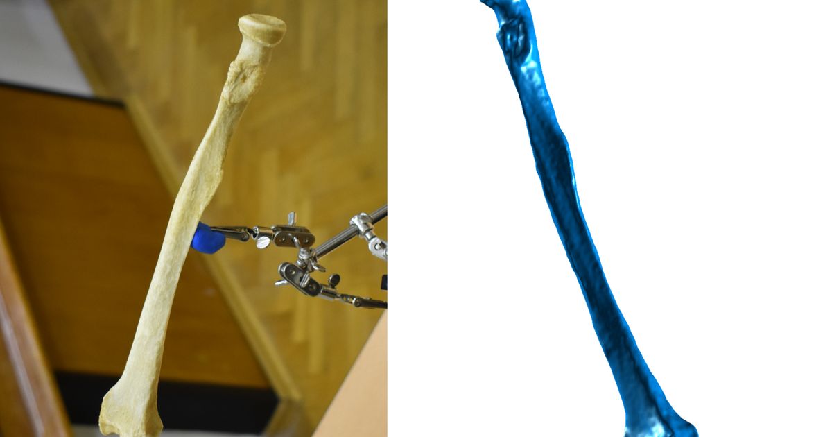 Forearm Bone Scan - Radius by KubiV | Download free STL model ...