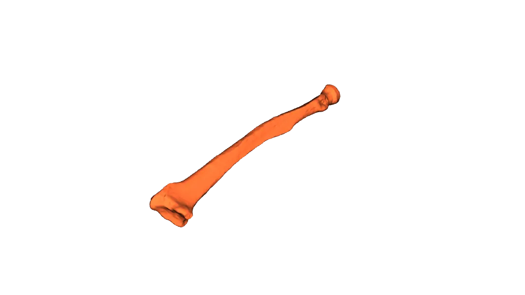 Forearm Bone Scan - Radius by KubiV | Download free STL model ...