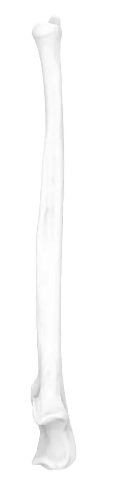 Ulna Left by Karel Pěnička | Download free STL model | Printables.com