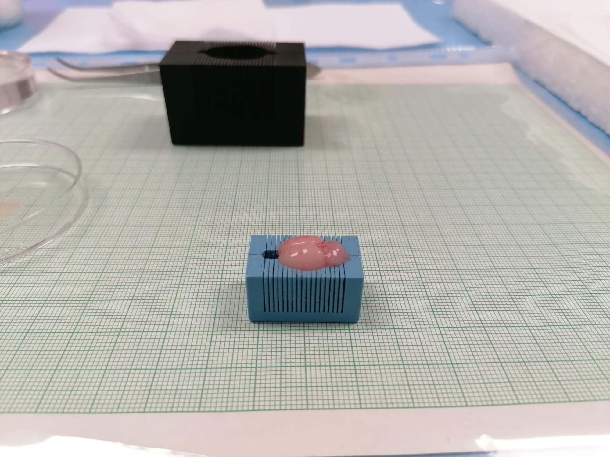 Brain matrix for slicing par Daniel | Éducation | Printables.com