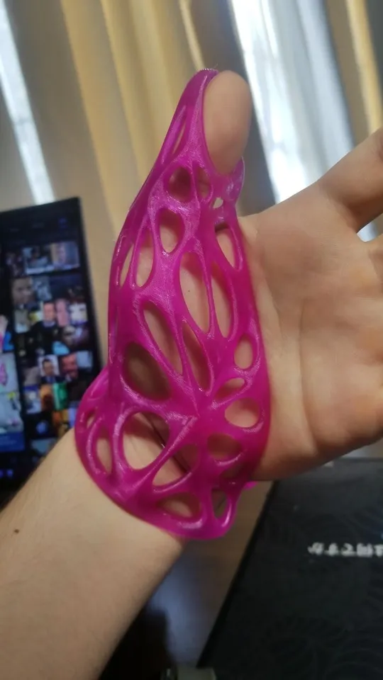 Custom-Fit Thumb Protector by Zoorger | Download free STL model ...