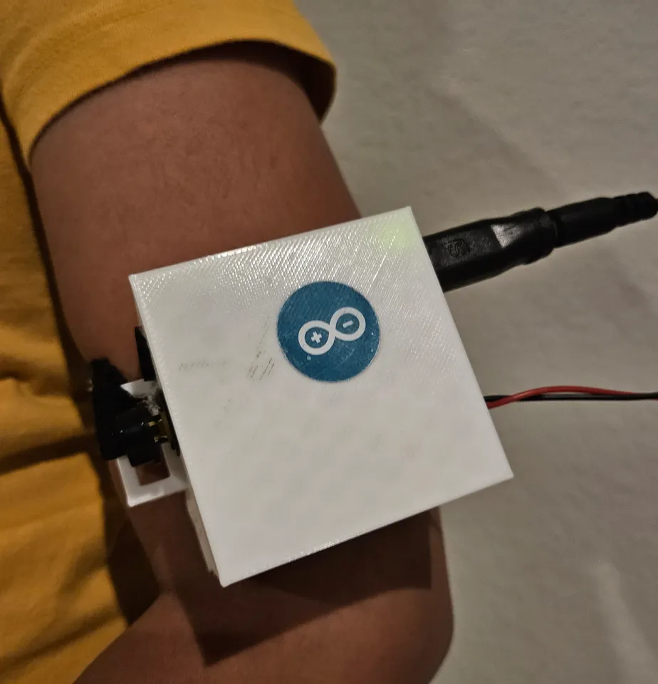 Fall Detection Module by Siddarth Nandyala | Download free STL model | Printables.com