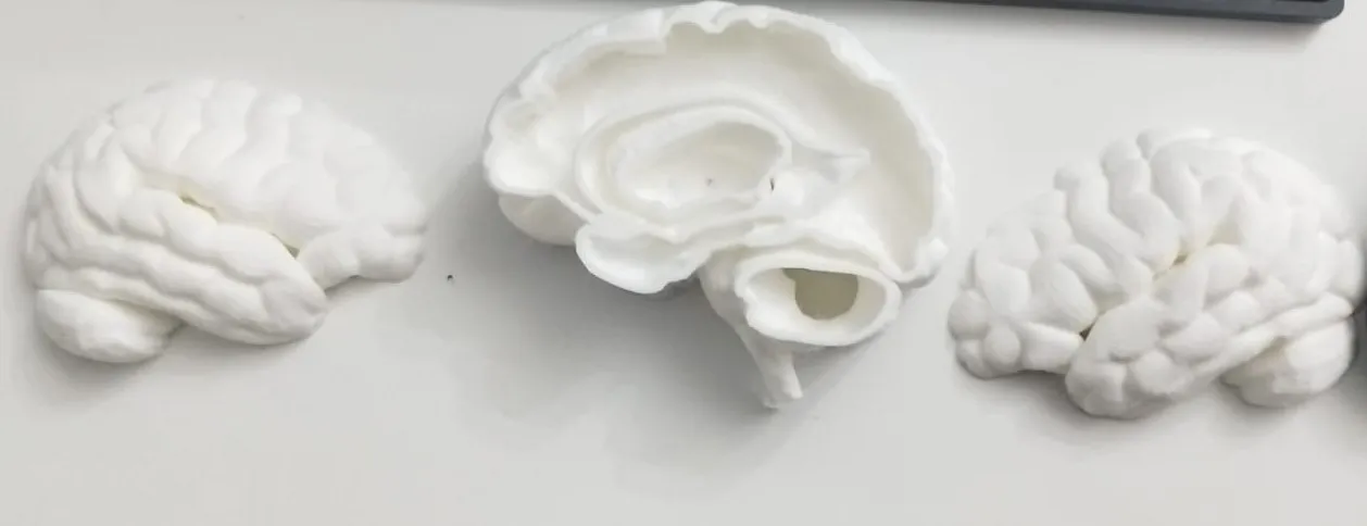 Hollow Brain by Deliano Dinca | Download free STL model | Printables.com